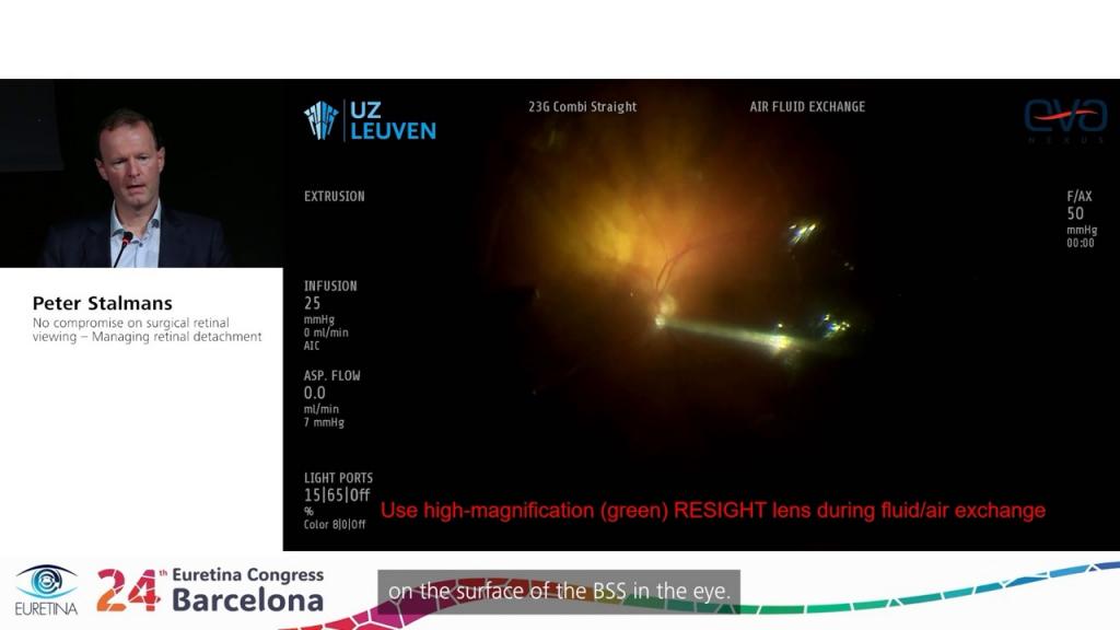 Single-use Lenses for ZEISS RESIGHT