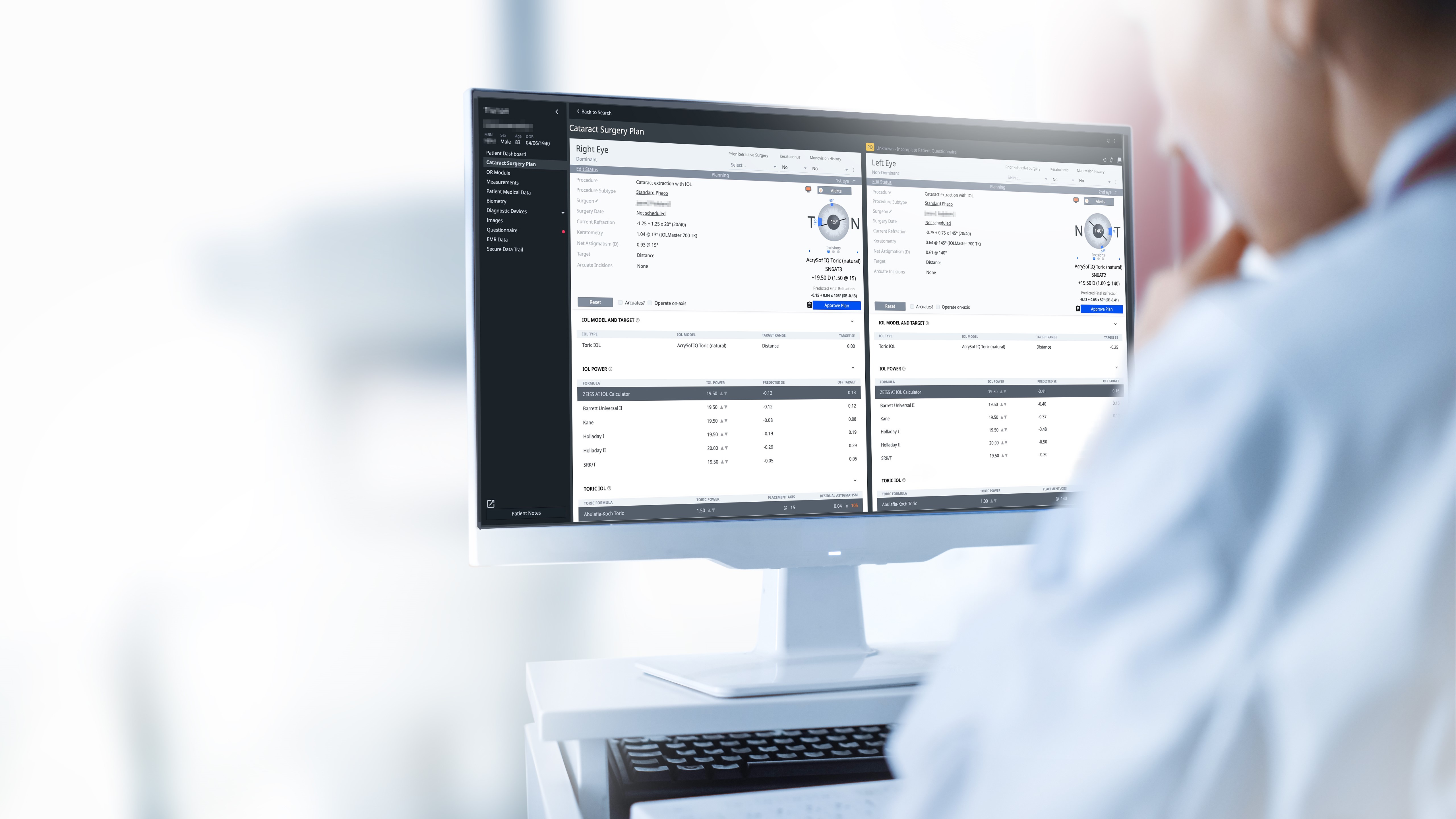 Zeiss Ai Iol Calculator Data Driven Iol Power Calculation Formula