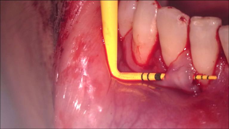 An outcome of a precise and intricate series of biological steps