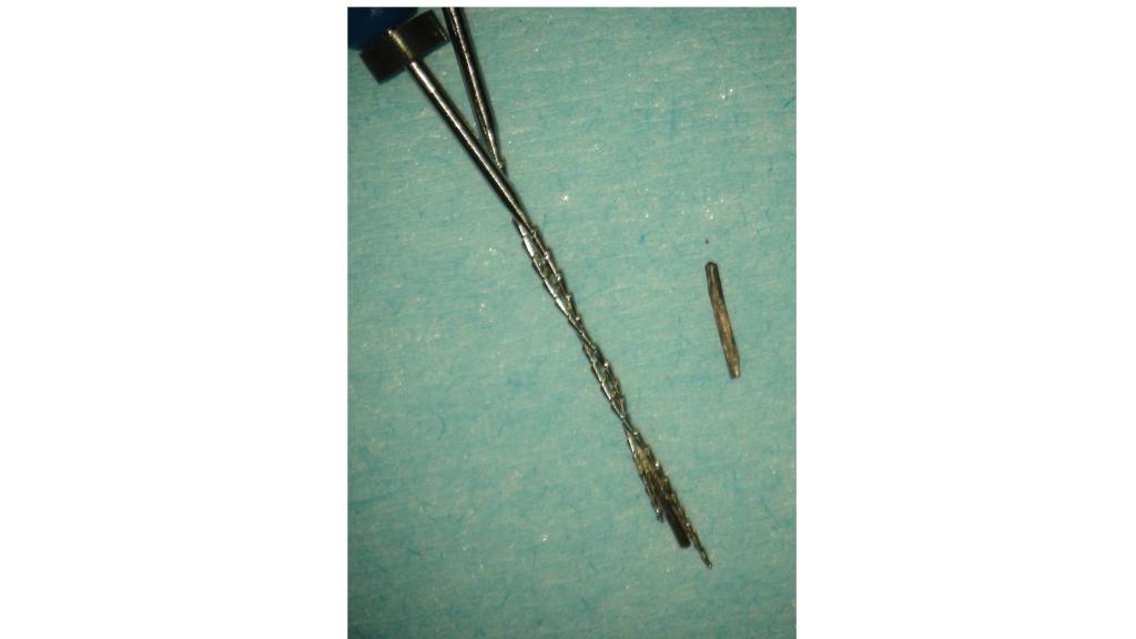 Non-surgical re-treatment