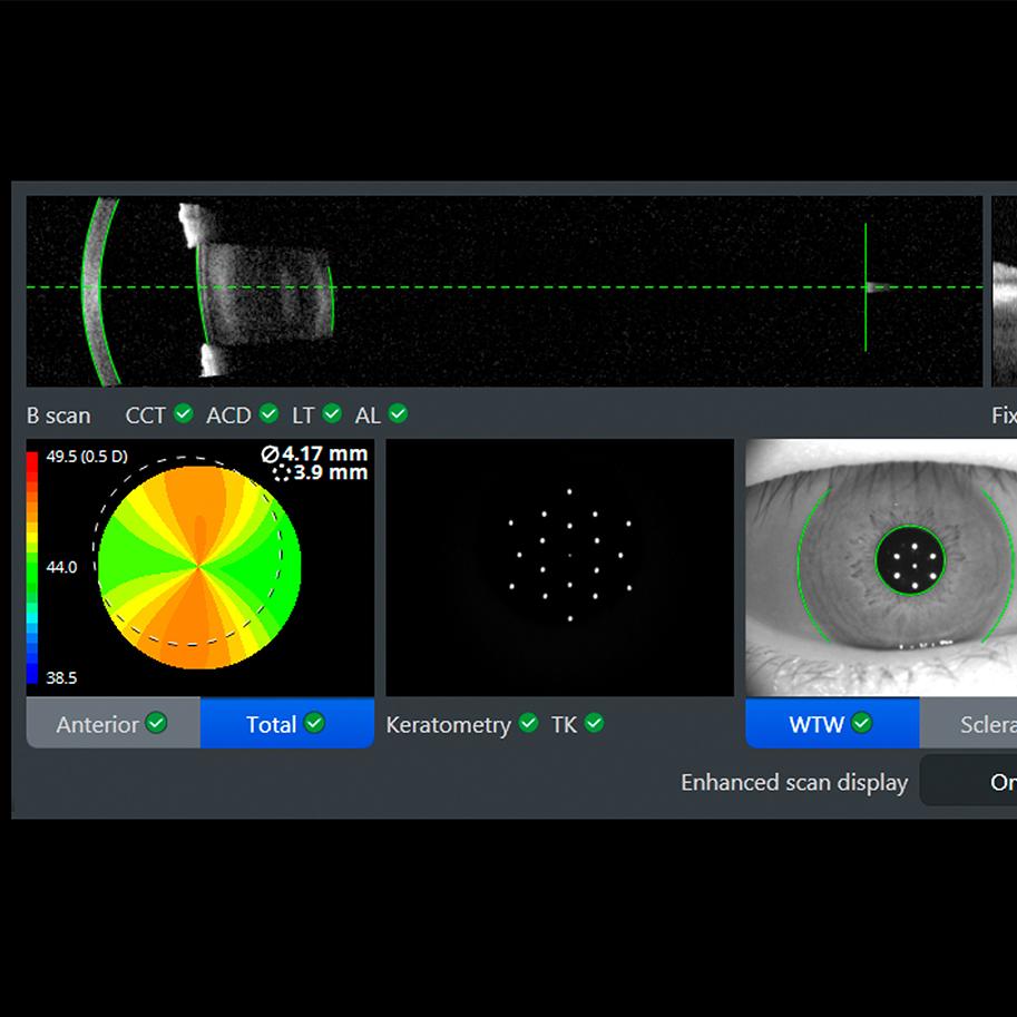 astigmatism simulator
