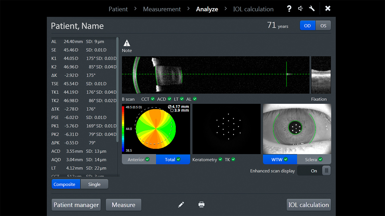 Astigmatism visualization and precise measurement