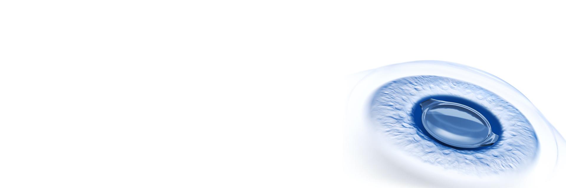 ZEISS Cataract Workflow