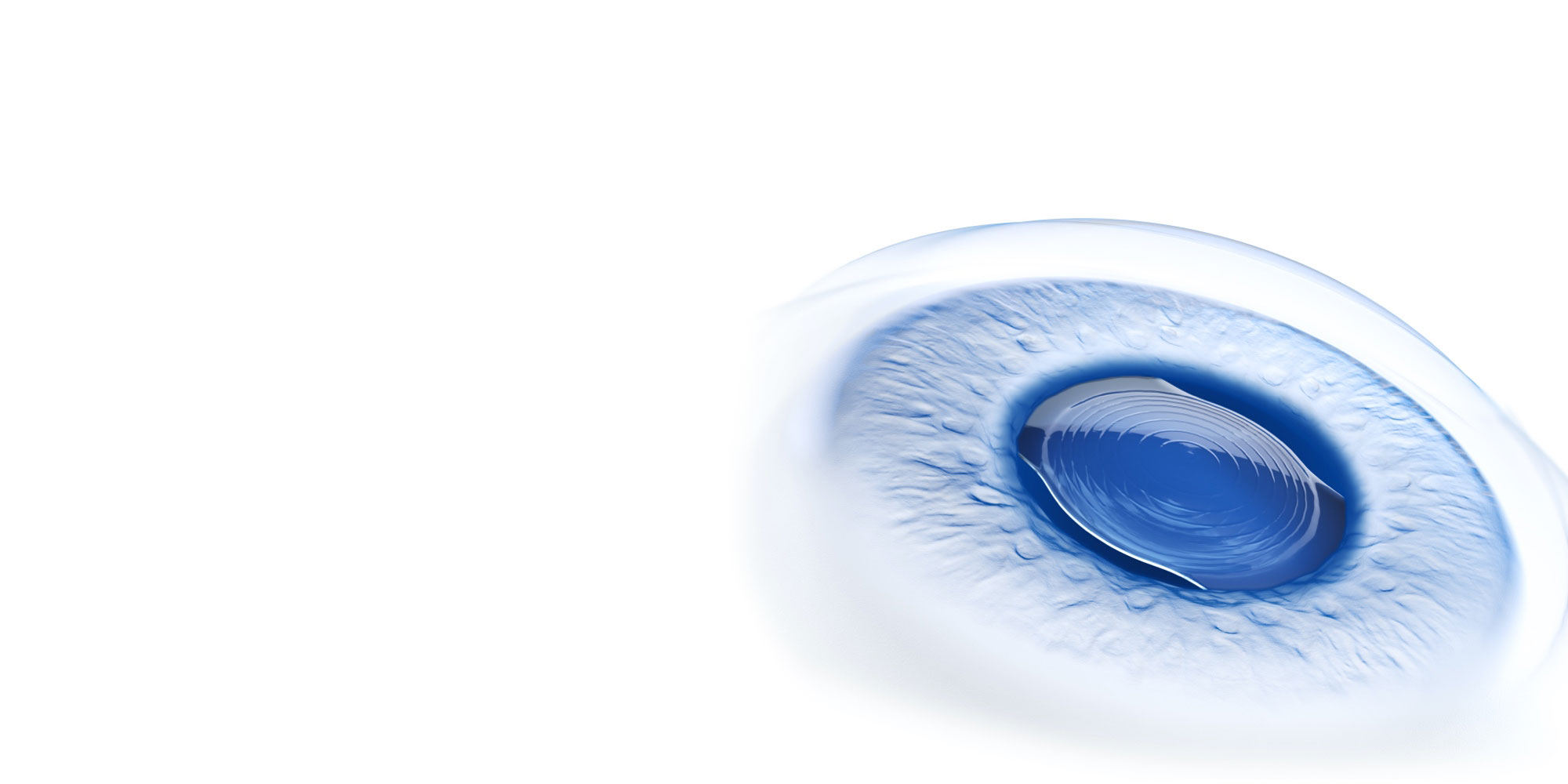 ZEISS Premium Cataract Workflow