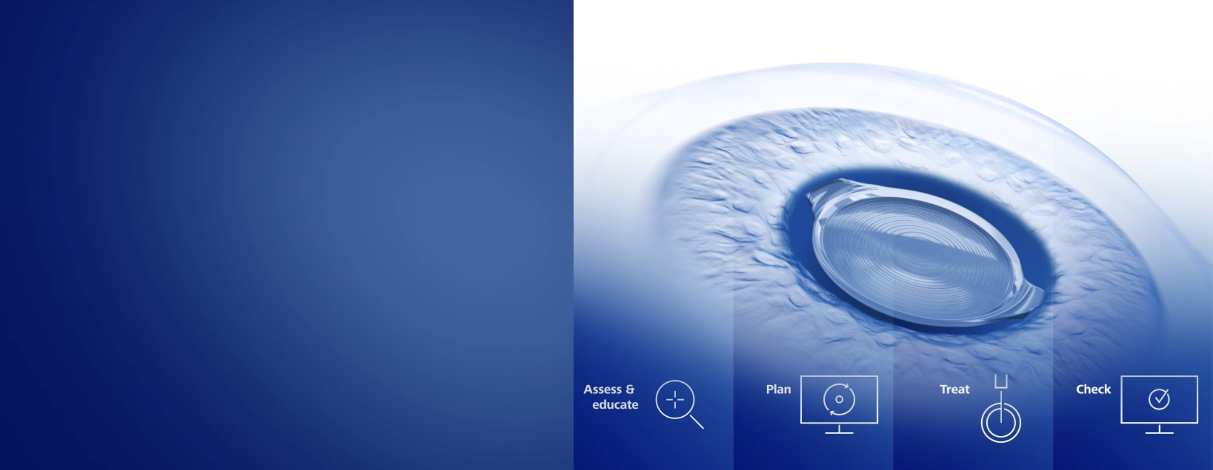 Premium Cataract Workflow | ZEISS Medical Technology