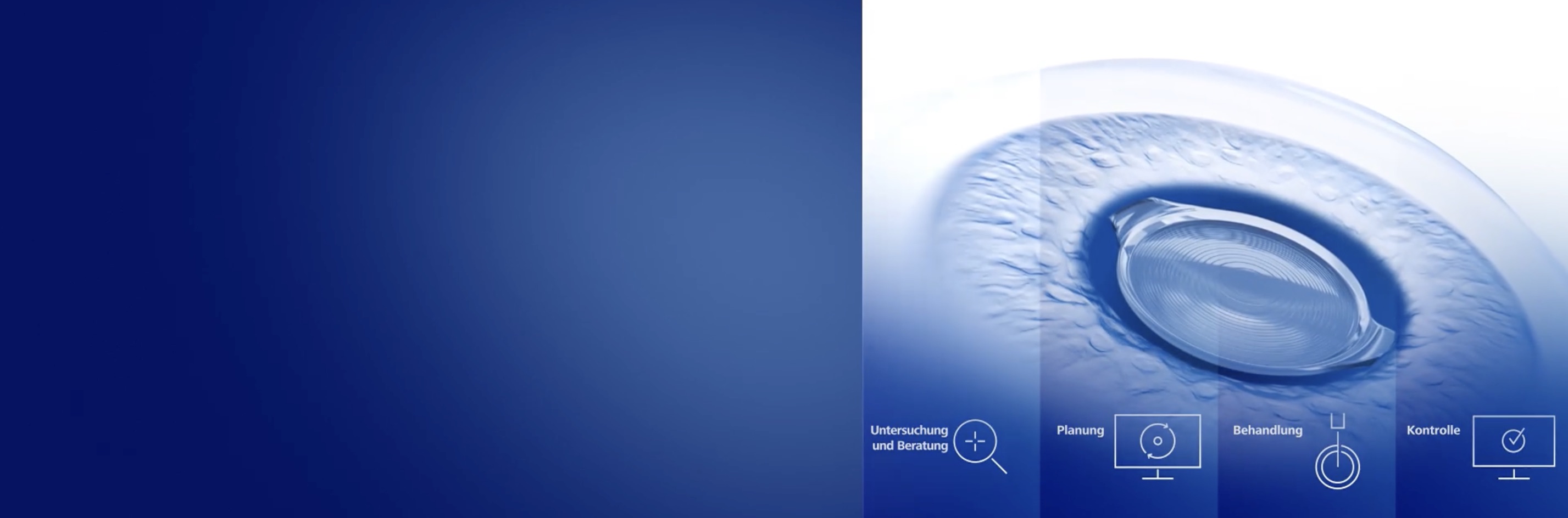 Premium Cataract Workflow | ZEISS Medical Technology