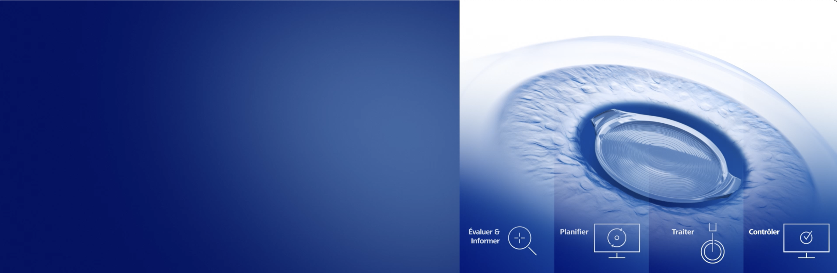 Premium Cataract Workflow | ZEISS Medical Technology