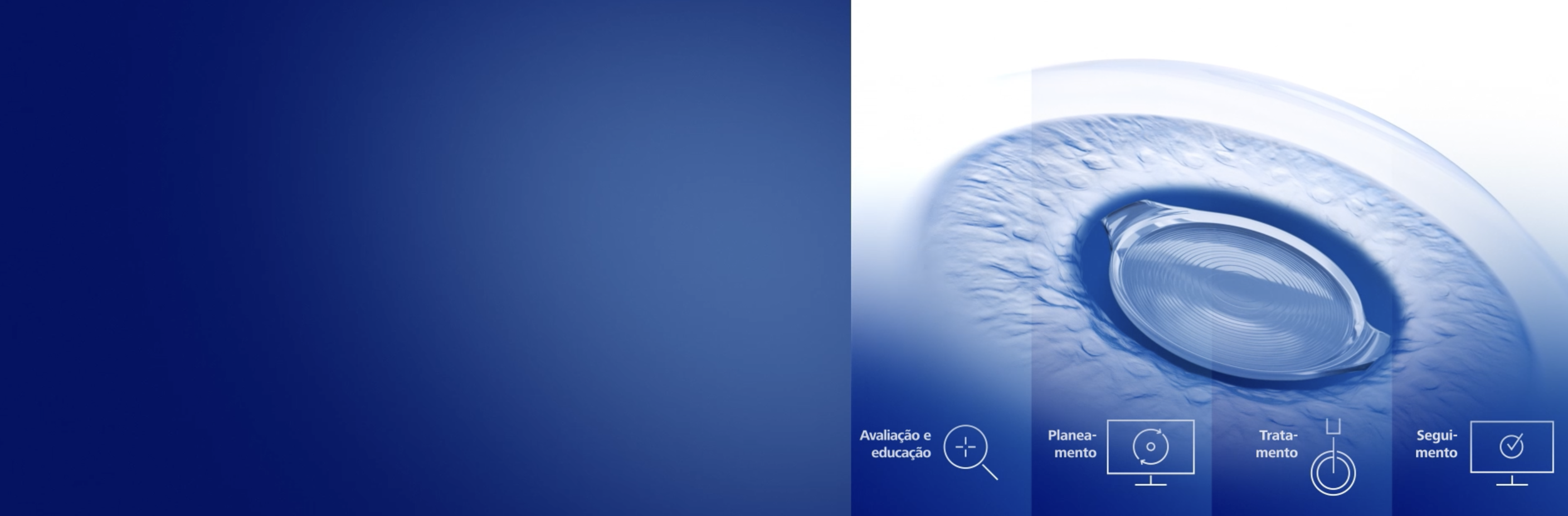 Premium Cataract Workflow | ZEISS Medical Technology