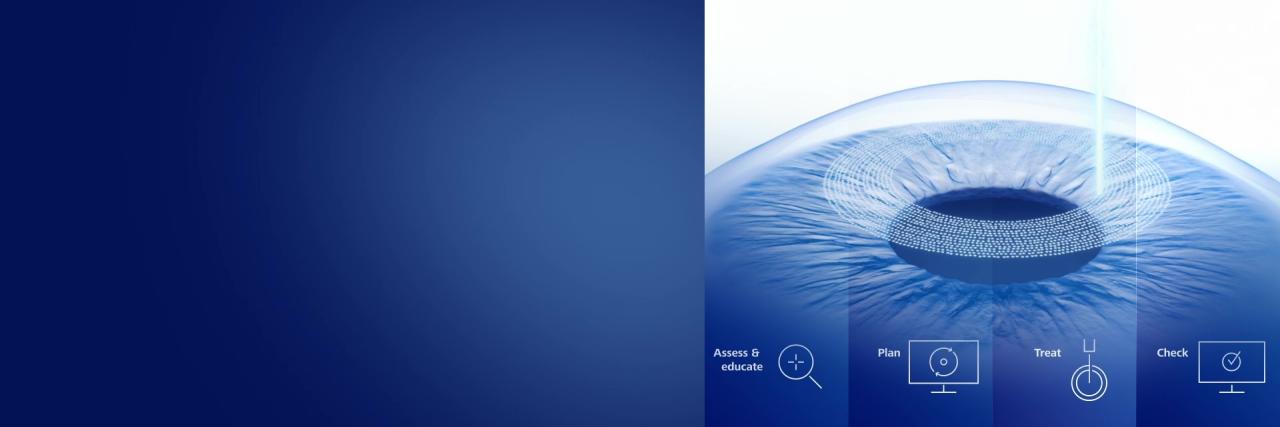 Corneal Refractive Workflow | ZEISS Medical Technology
