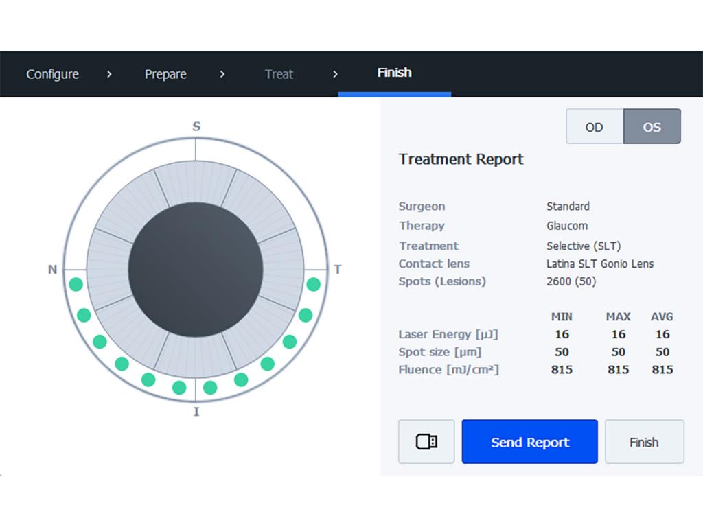 Glaucoma Clinical Challenge Page