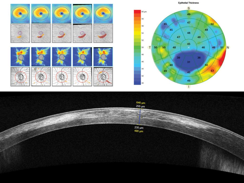 Glaucoma Clinical Challenge Page