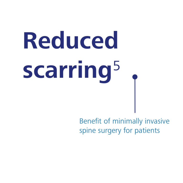 Minimal Invasive Spine Surgery (MISS) – ZEISS Medical Technology