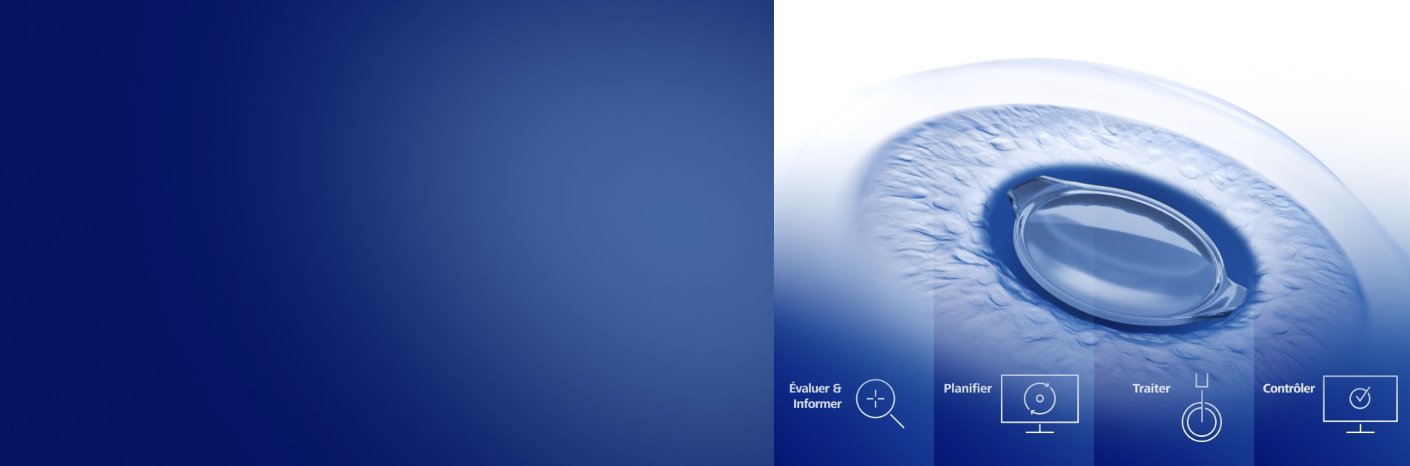 ZEISS Cataract Workflow