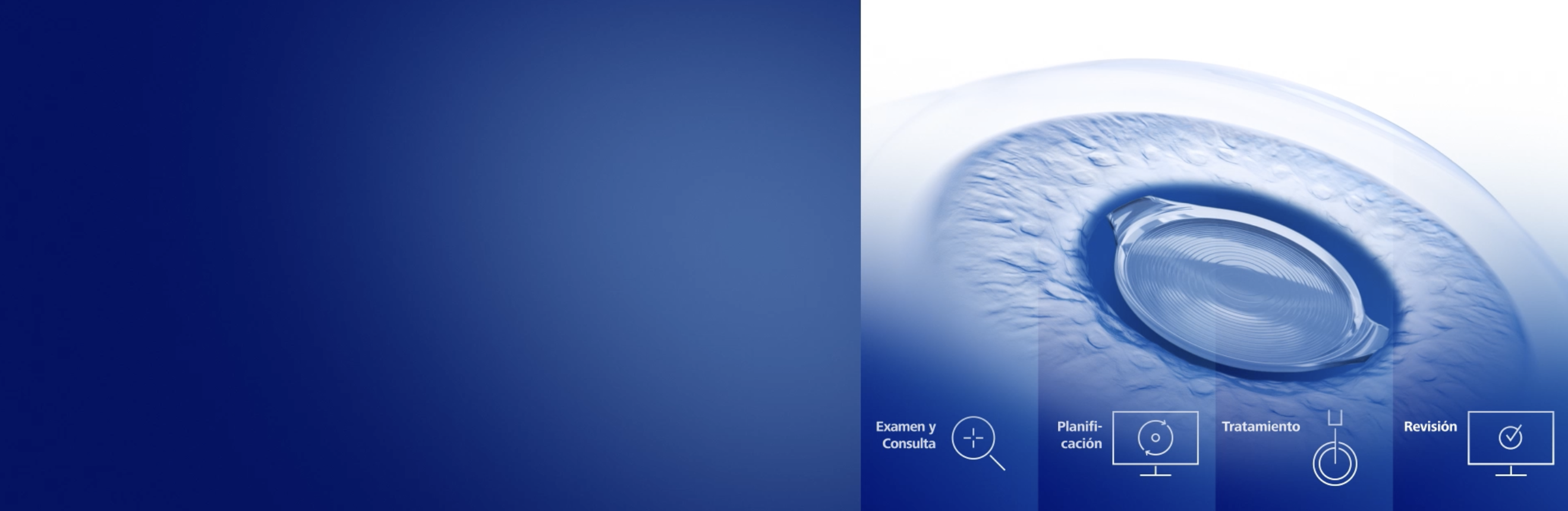 ZEISS Cataract Workflow