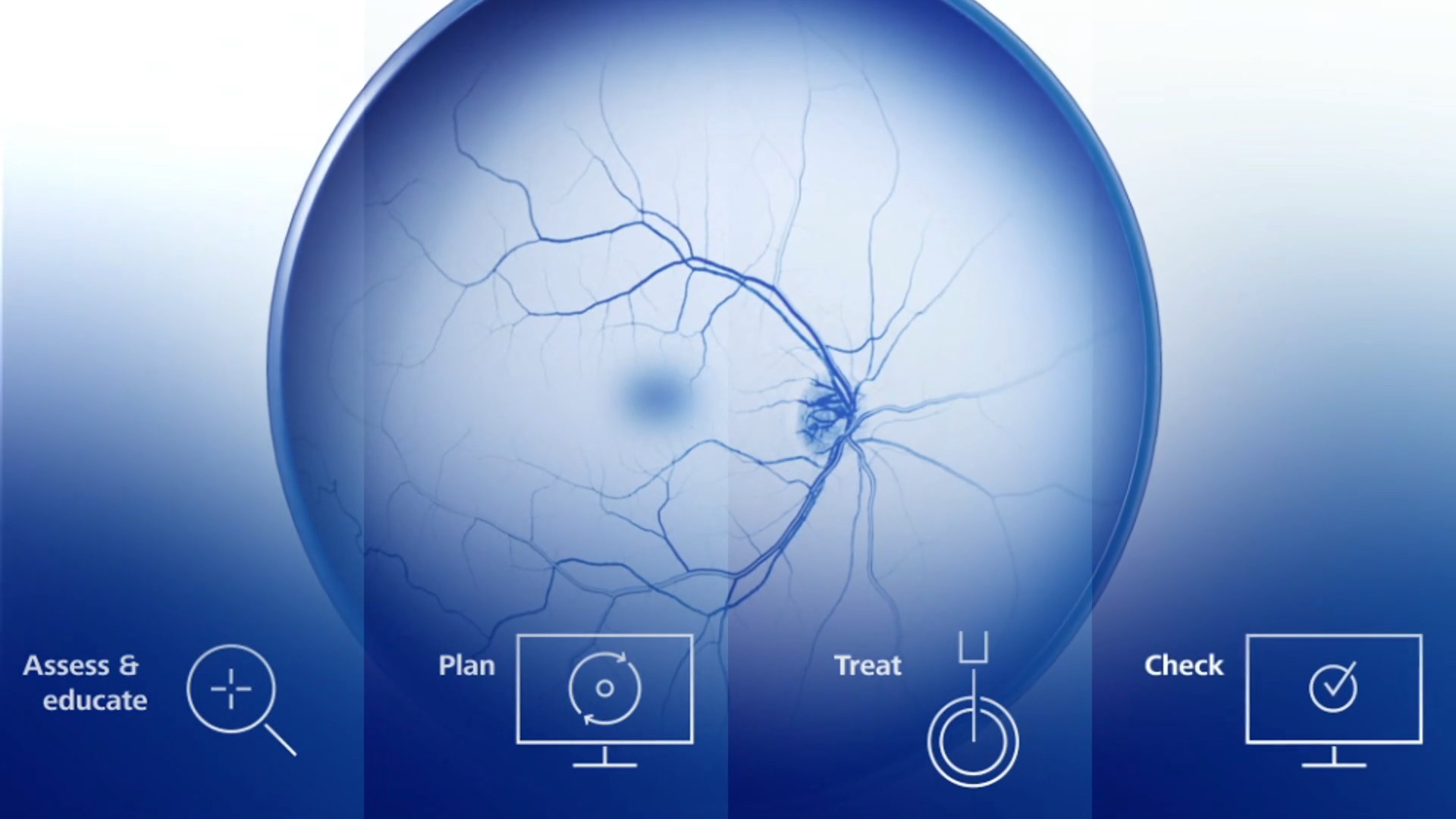 ZEISS VISULAS green | ZEISS Medical Technology