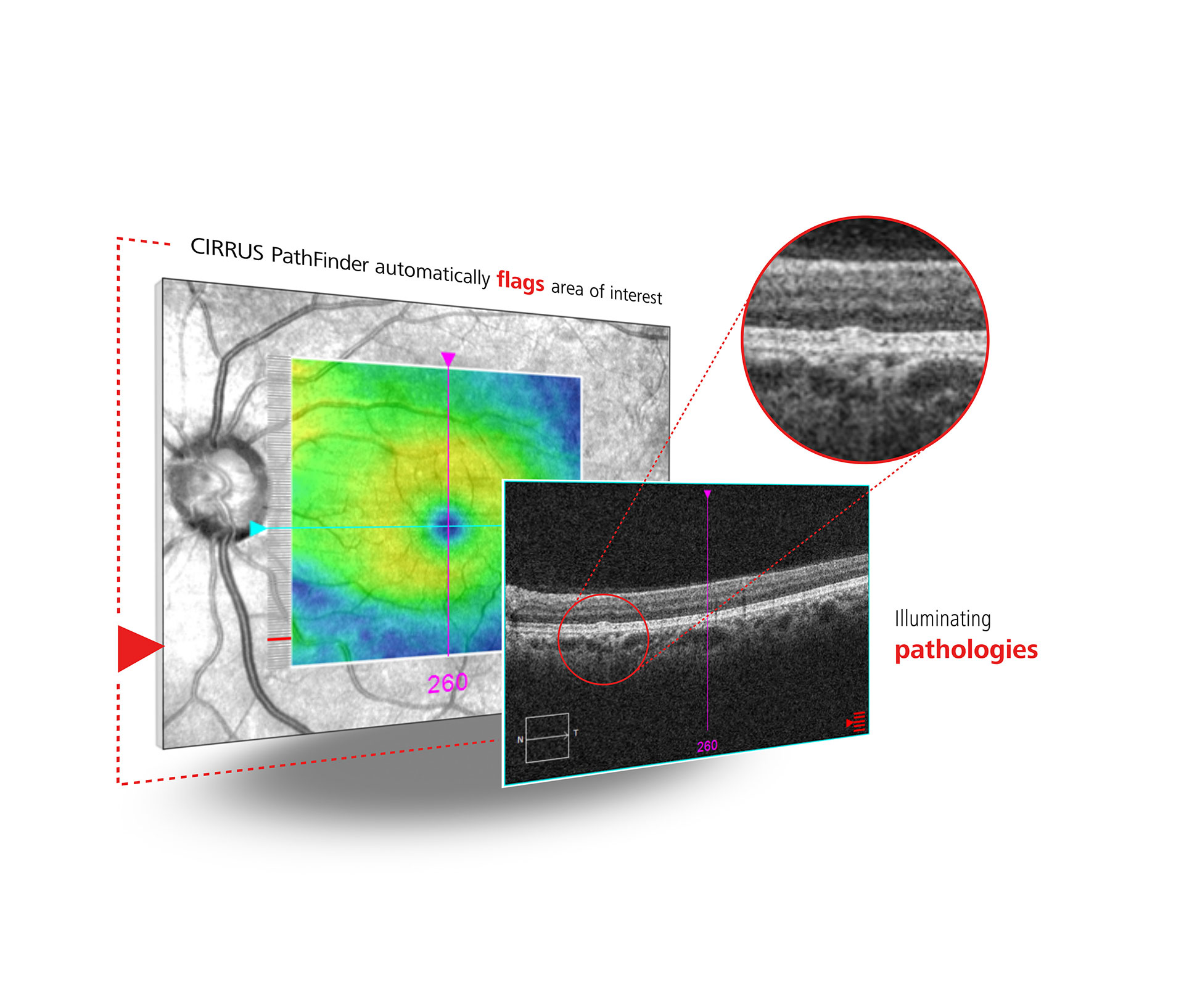 ZEISS announces CE mark for CIRRUS PathFinder AI tool with automated ...