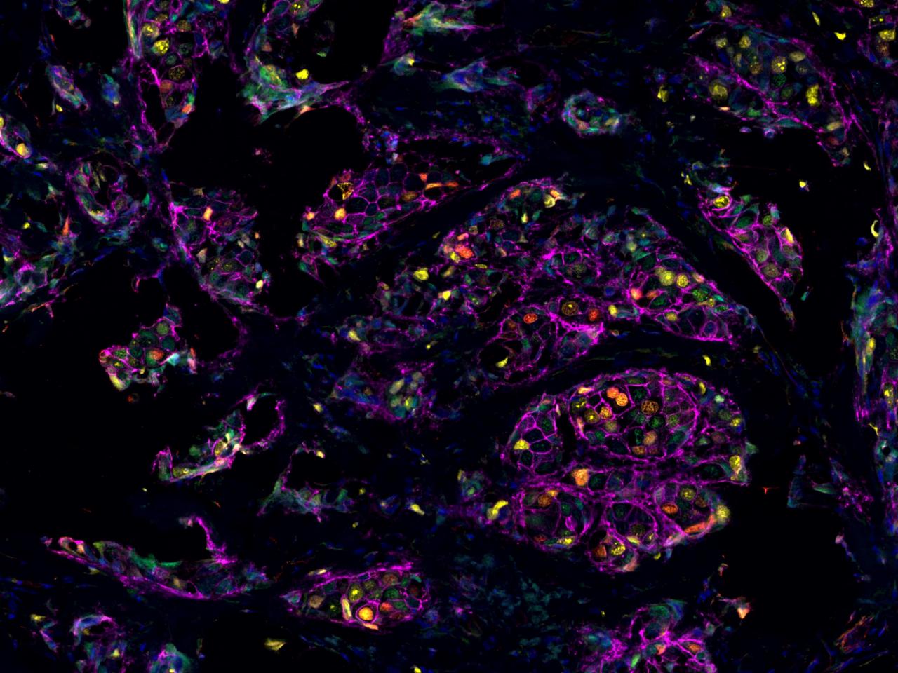 ZEISS Microscopy for Cancer Research