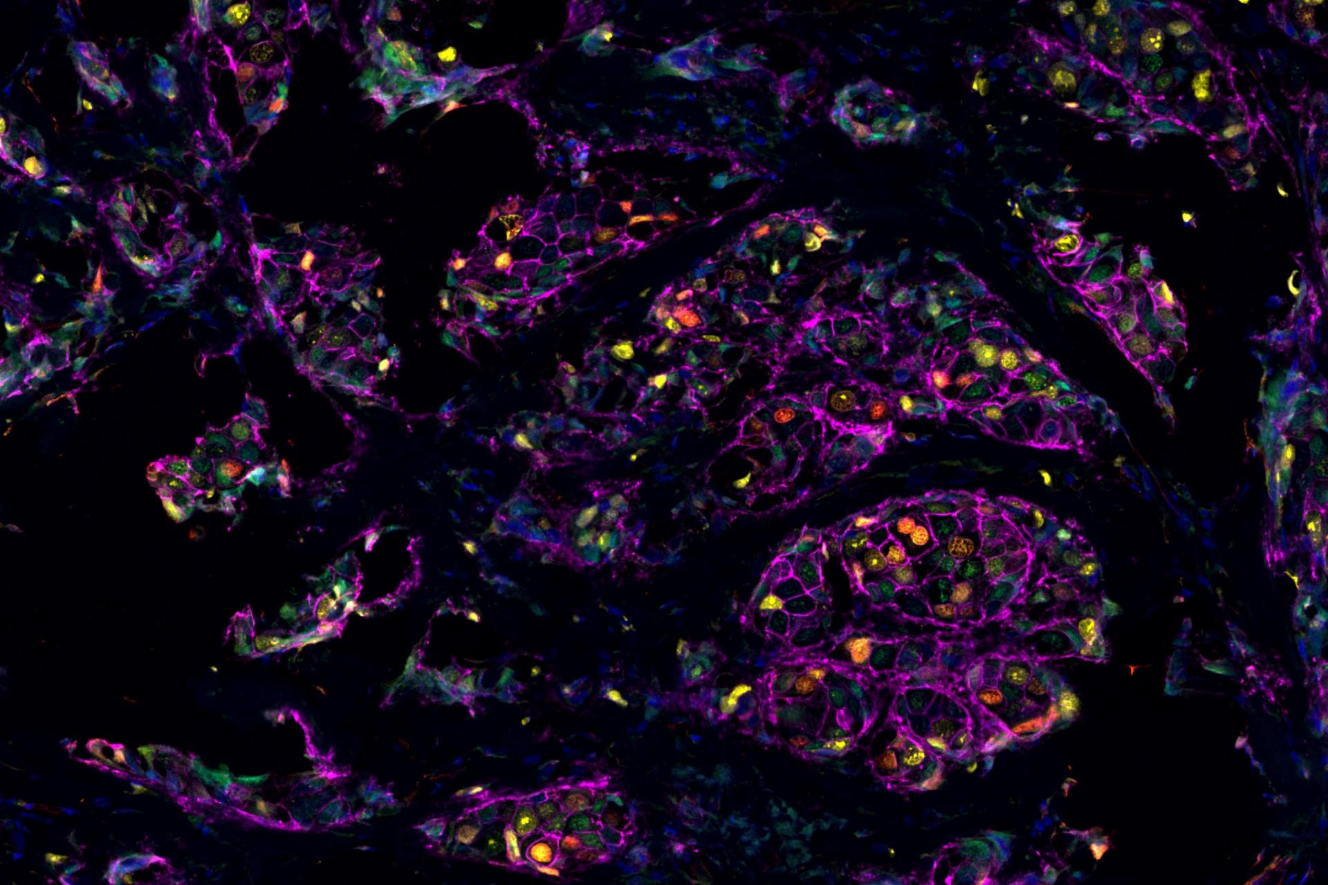 ZEISS Microscopy for Cancer Research