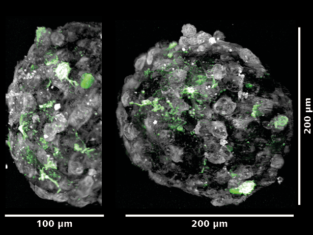 ZEISS Microscopy for Cancer Research