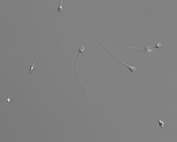 ZEISS Microscopy for In Vitro Fertilization