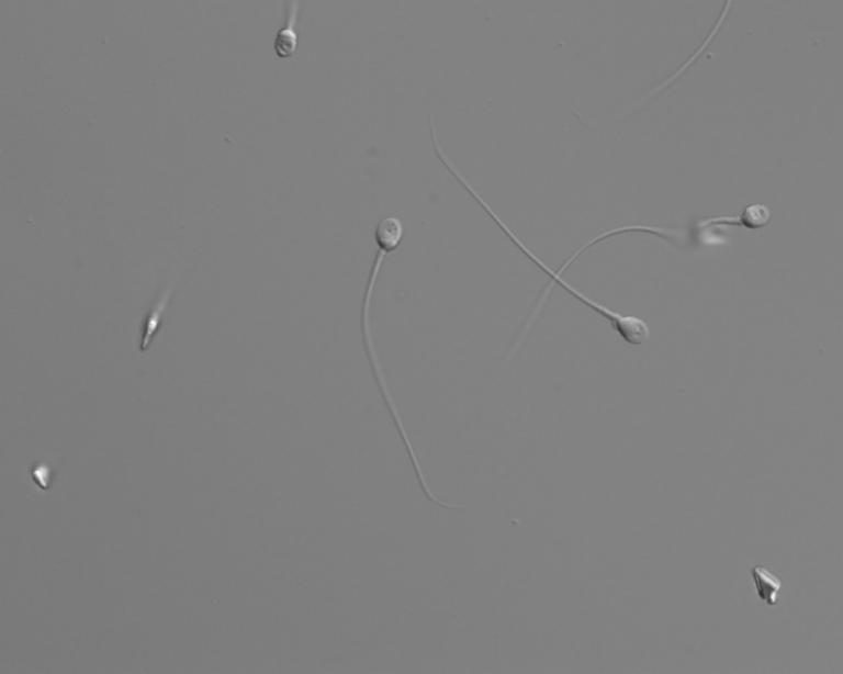 ZEISS Microscopy for In Vitro Fertilization
