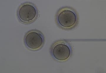 ZEISS Microscopy for In Vitro Fertilization