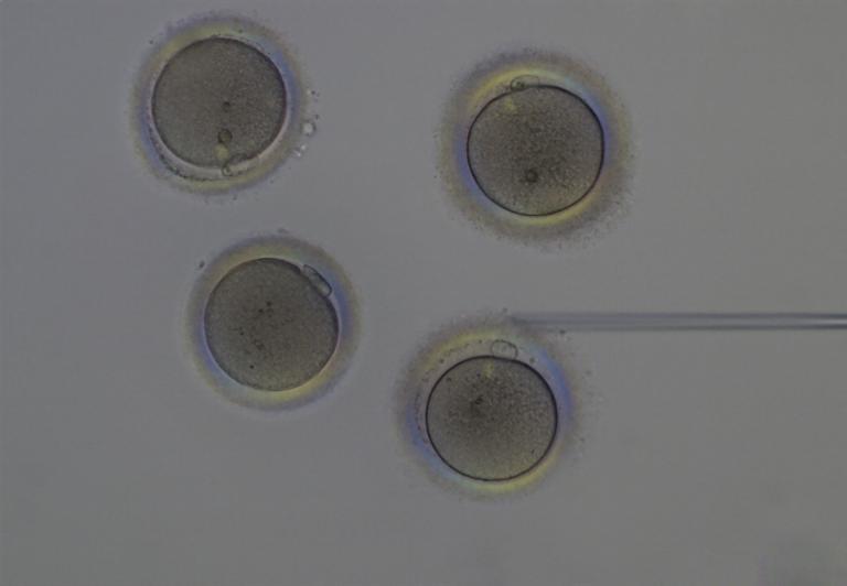 ZEISS Microscopy for In Vitro Fertilization