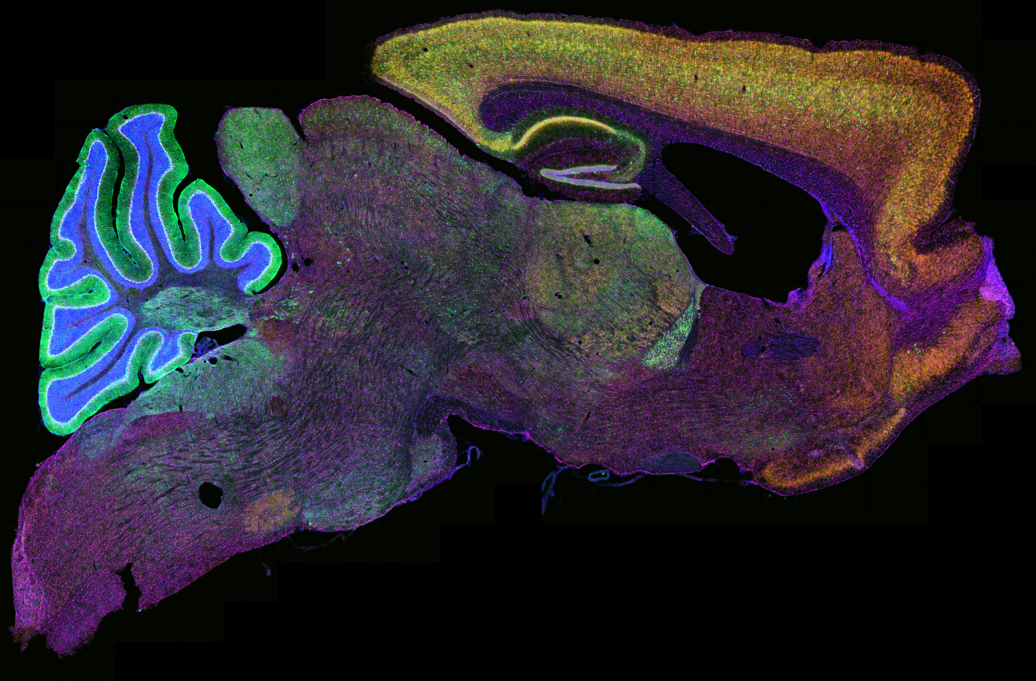 ZEISS Microscopy for Neuroscience Research