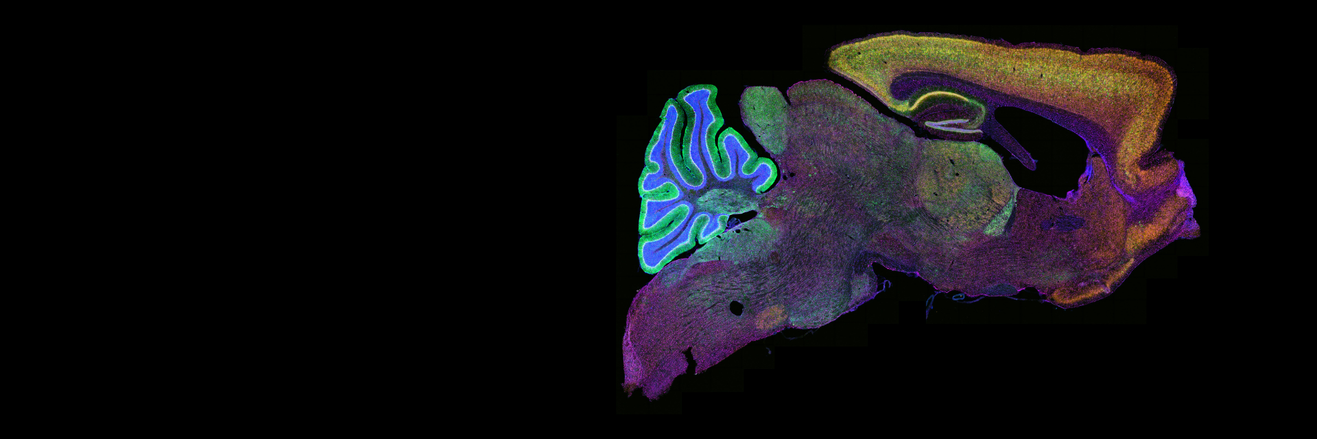 ZEISS Microscopy for Neuroscience Research