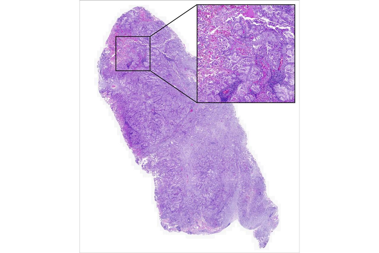 Microscopy Solutions for Pathology | ZEISS Microscopy US