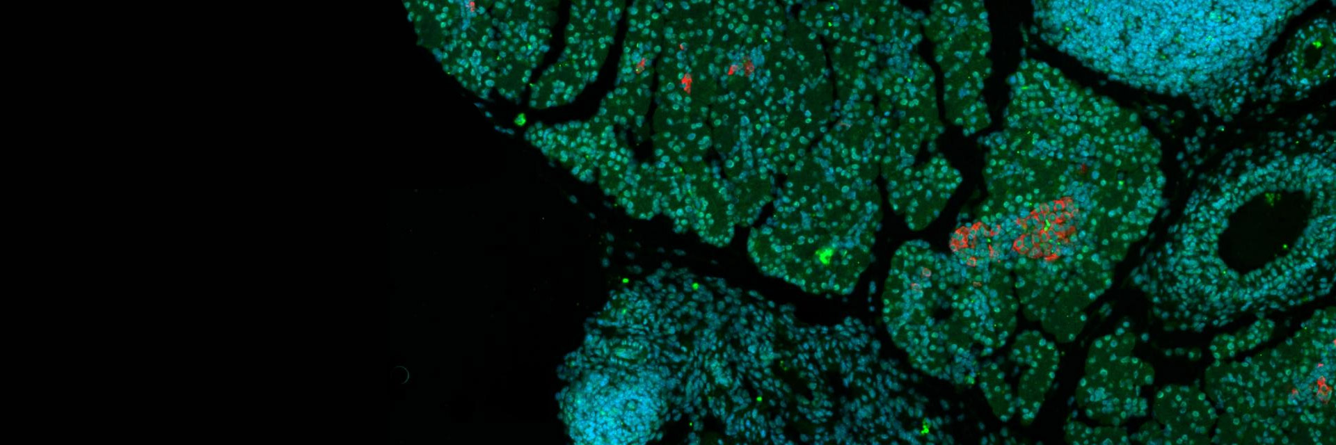 Microscopy Solutions for Pathology | ZEISS Microscopy US