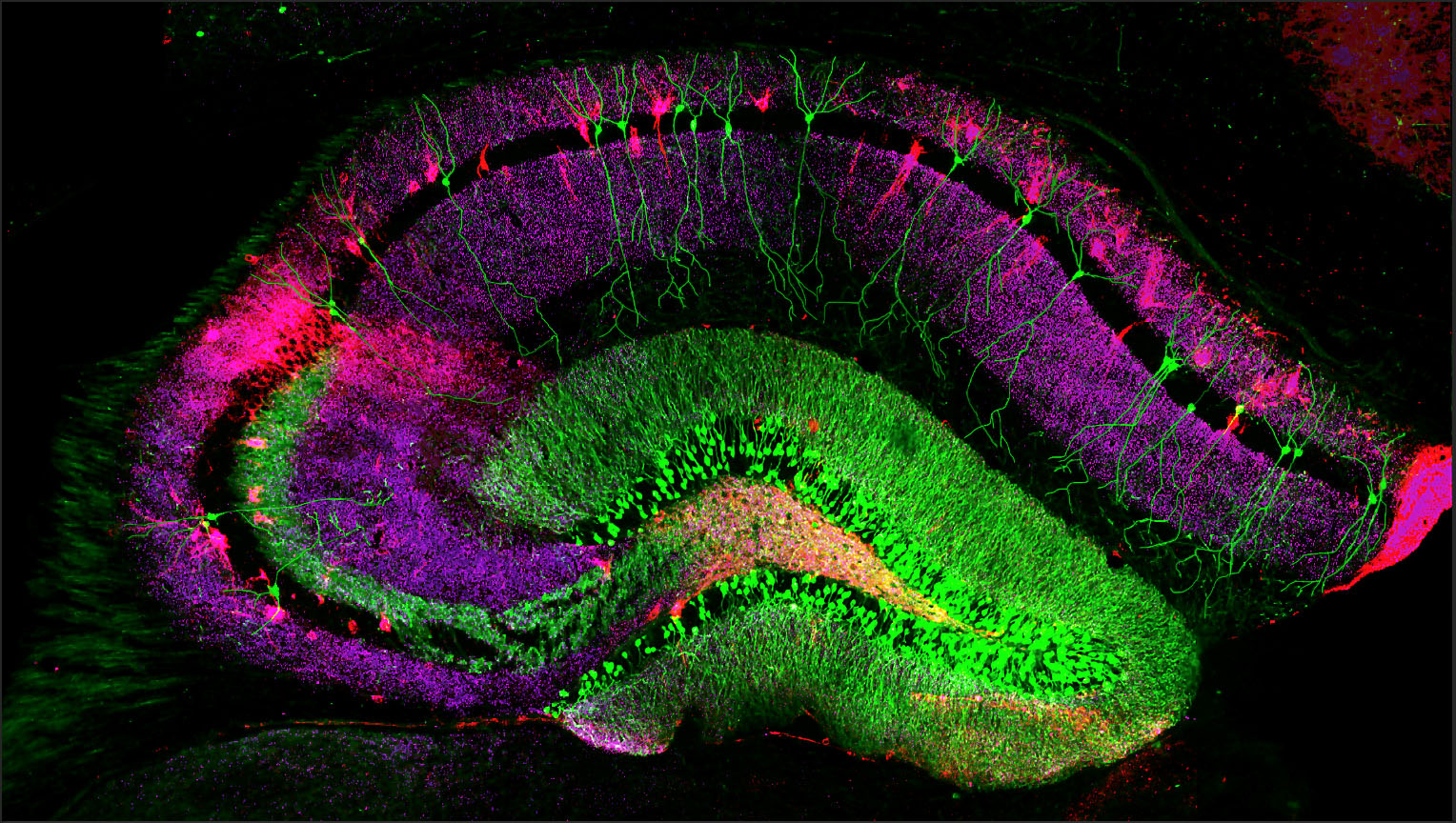 Imaging Applications in Neuroscience Summit Abstracts