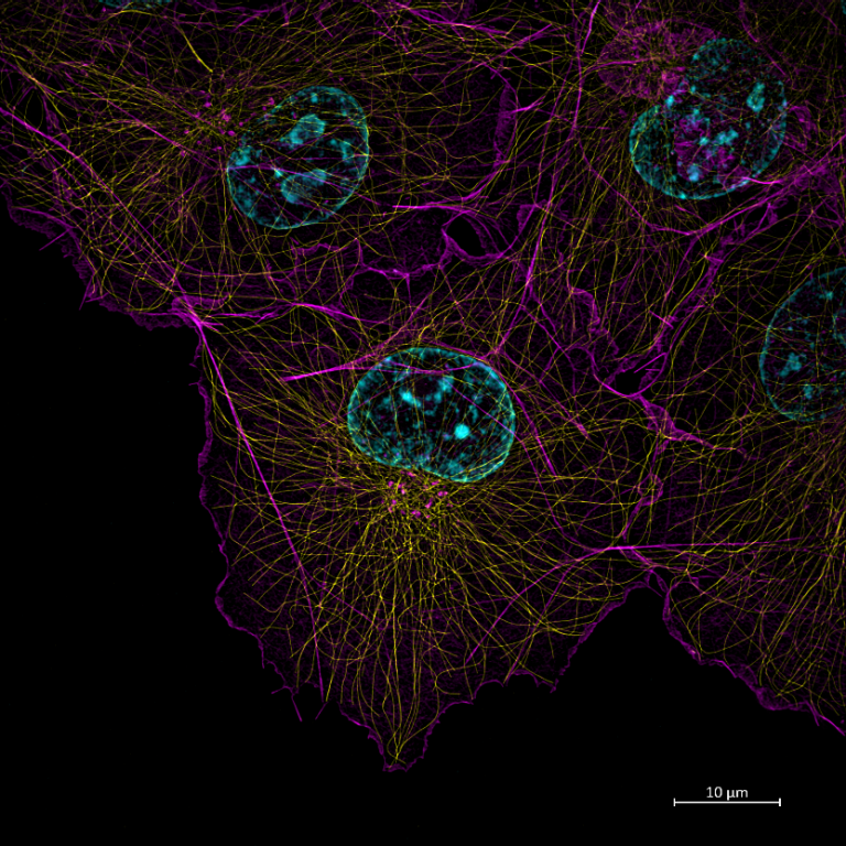 Unlocking live super resolution with ZEISS Lattice SIM 5 Workshop