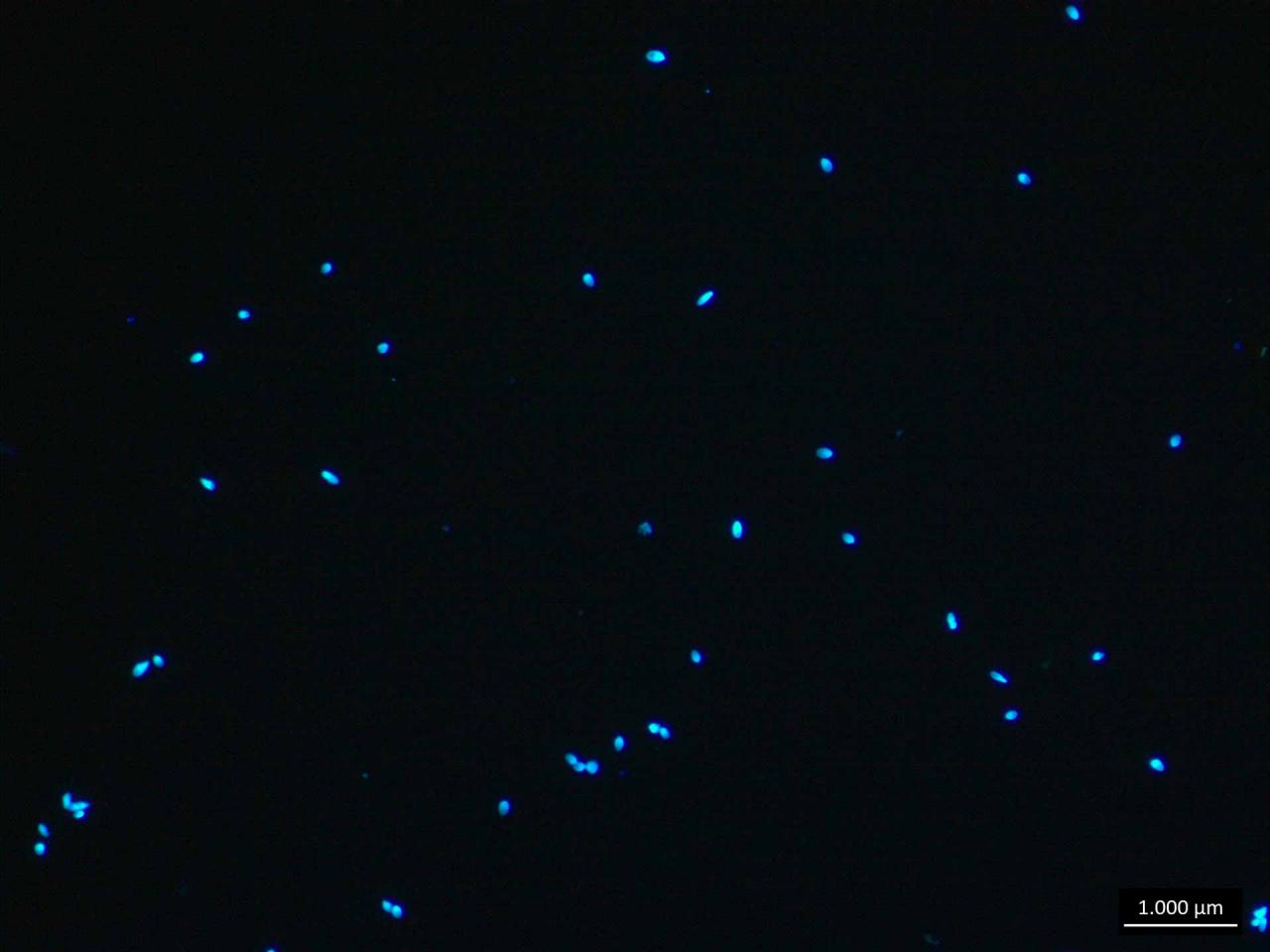 Forensic DNA Profiling