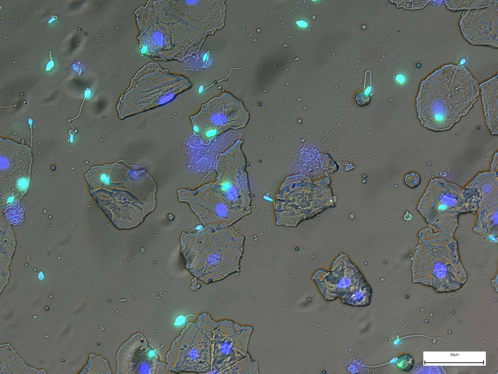 Forensic DNA Profiling