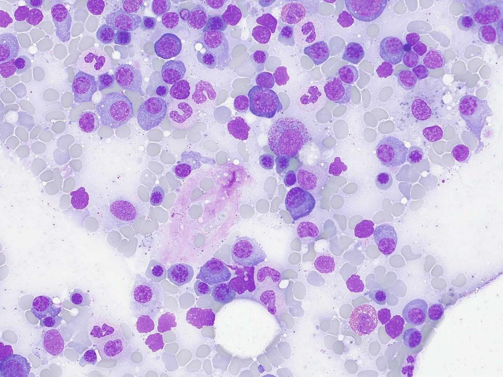 Microscopio De Glóbulos Blancos Y Rojos