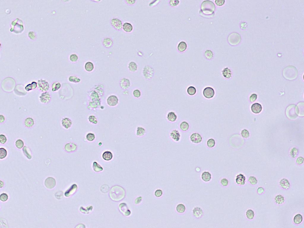 Microscopy Solutions for Urinalysis | ZEISS