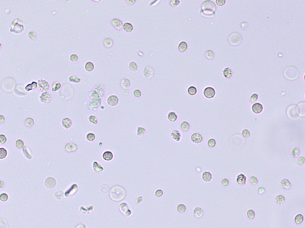 Microscopy Solutions for Urinalysis | ZEISS