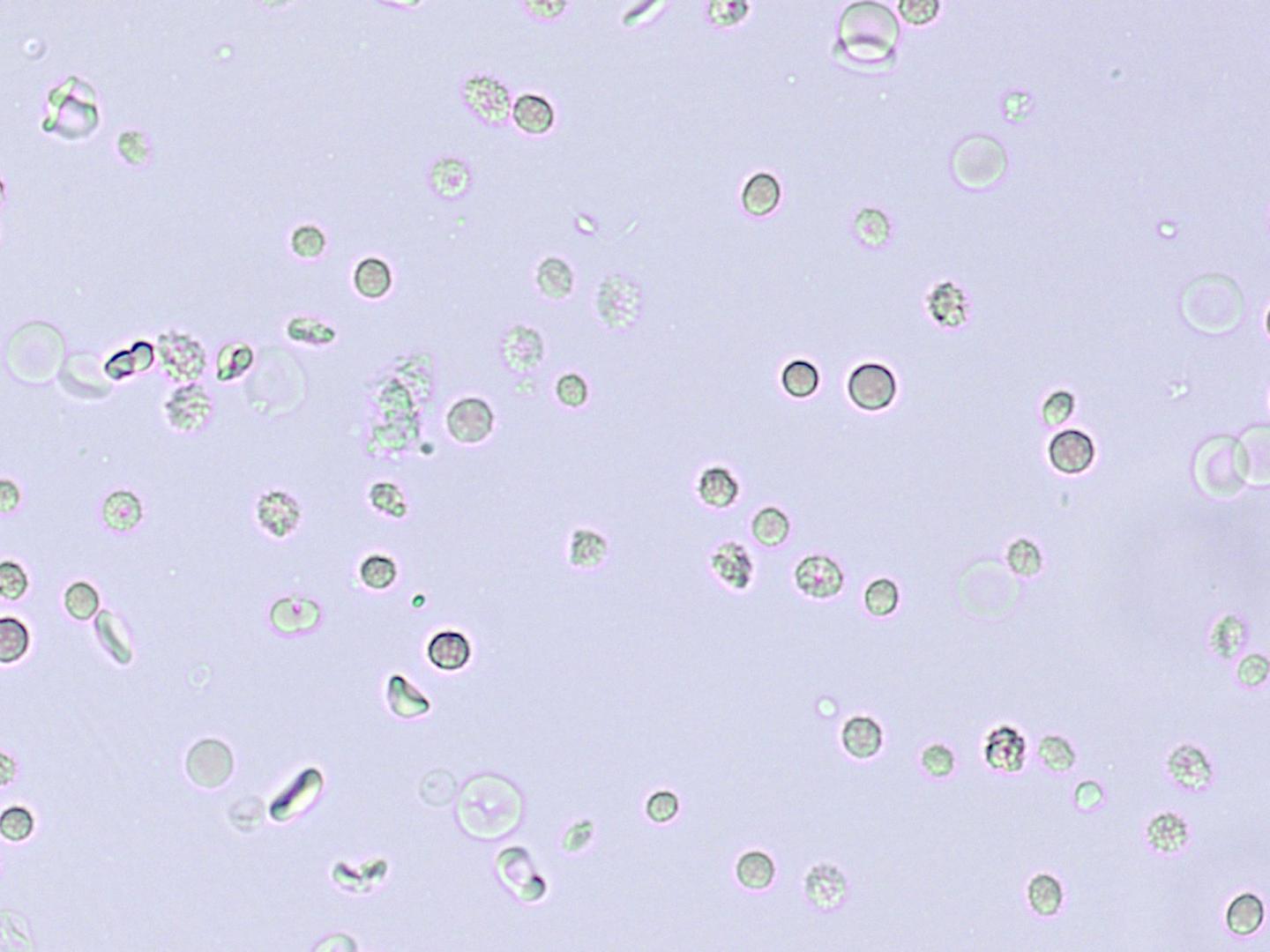 Microscopy Solutions for Urinalysis | ZEISS