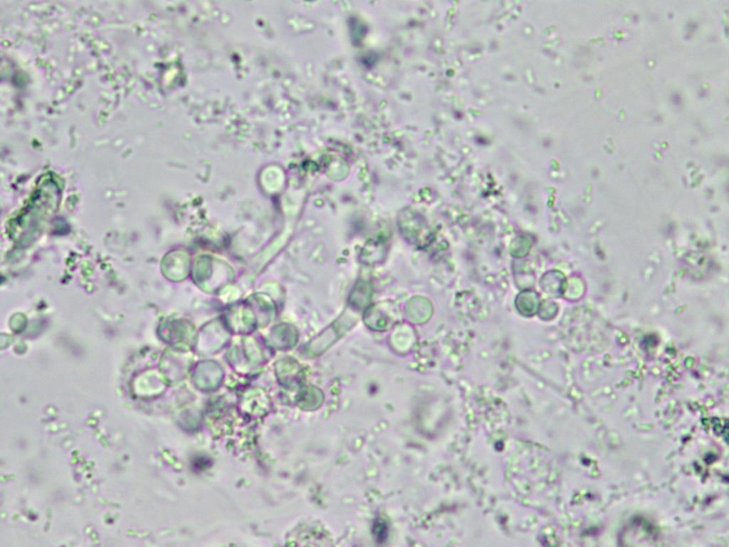 Microscopy Solutions for Urinalysis | ZEISS