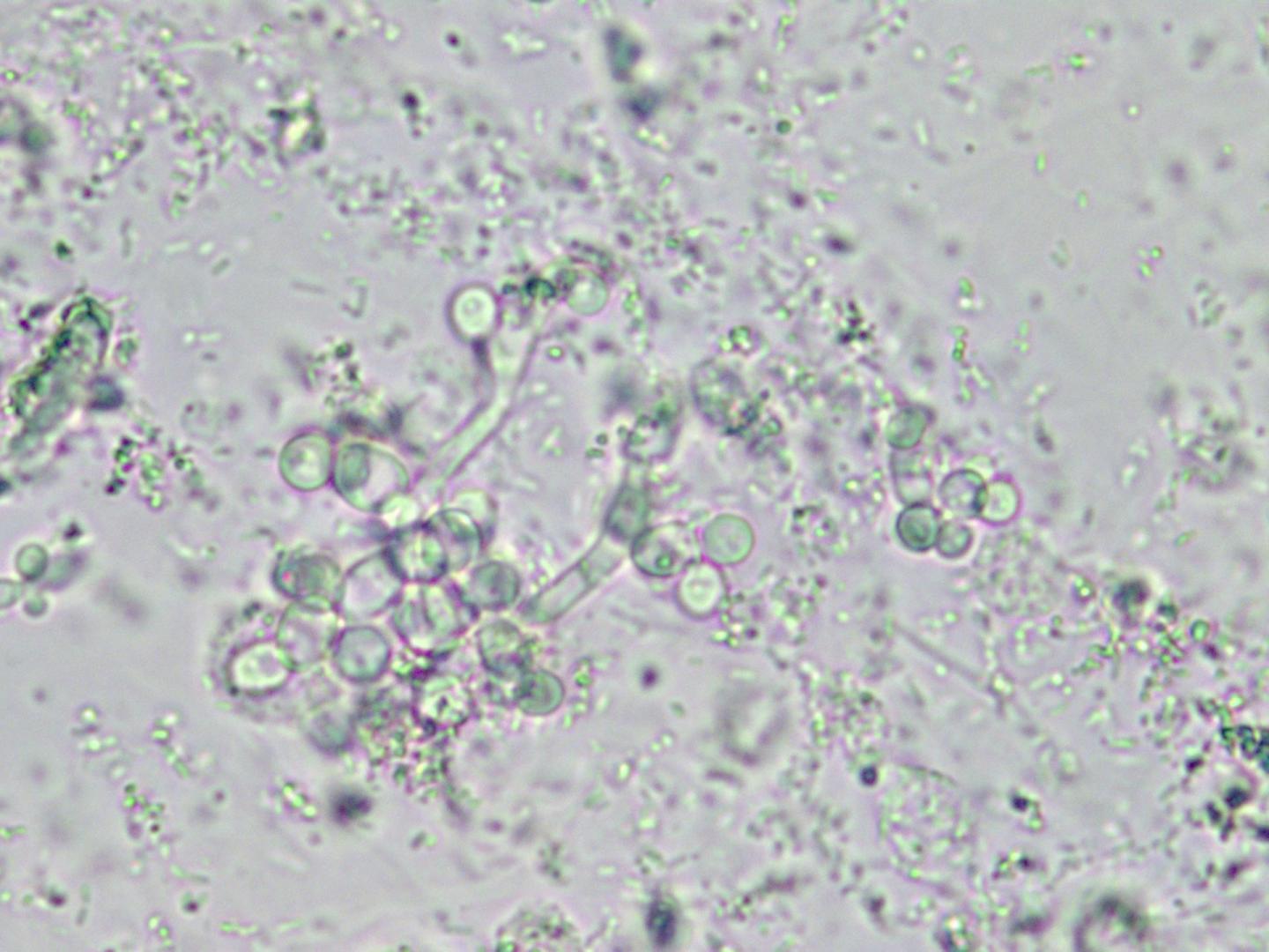 Microscopy Solutions for Urinalysis | ZEISS