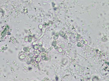 Microscopy Solutions for Urinalysis | ZEISS