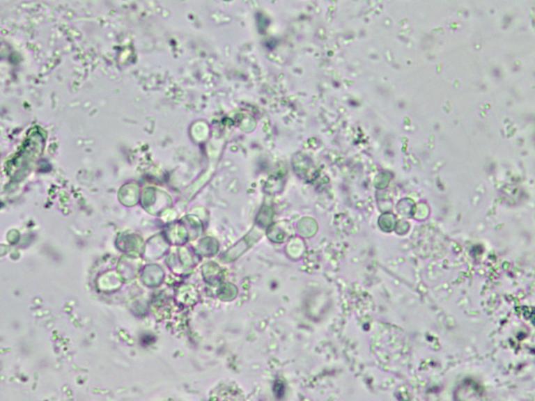 Microscopy Solutions for Urinalysis | ZEISS