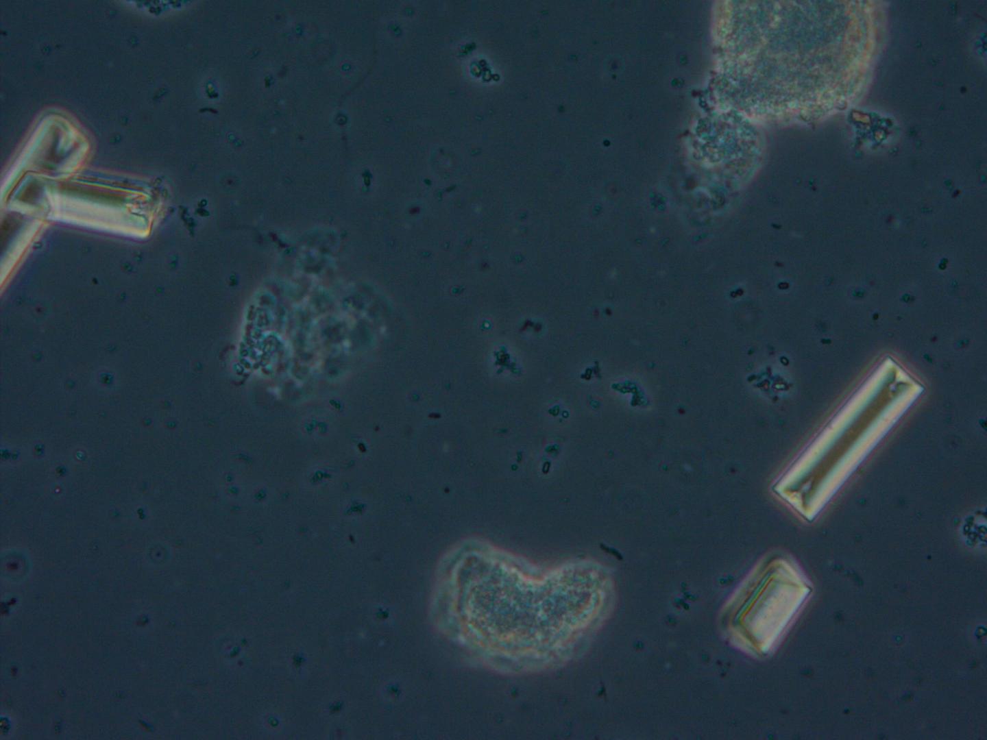 Microscopy Solutions for Urinalysis | ZEISS