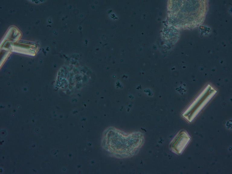 Microscopy Solutions for Urinalysis | ZEISS