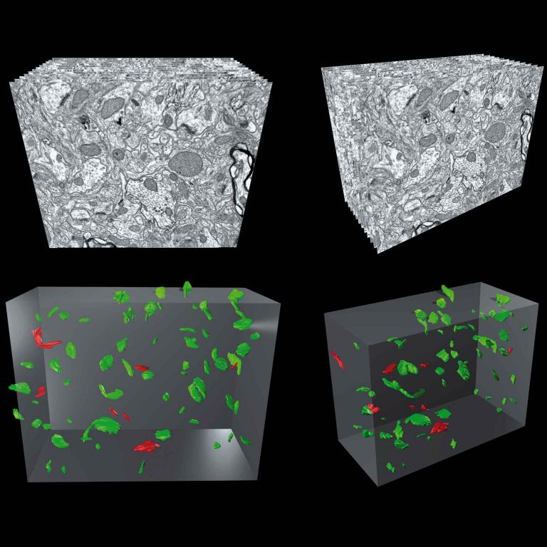 Connectomics Unraveling The Wiring Of Neural Networks