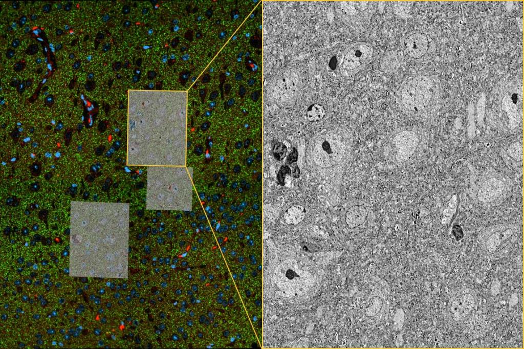 Connectomics: Unraveling the Wiring of Neural Networks