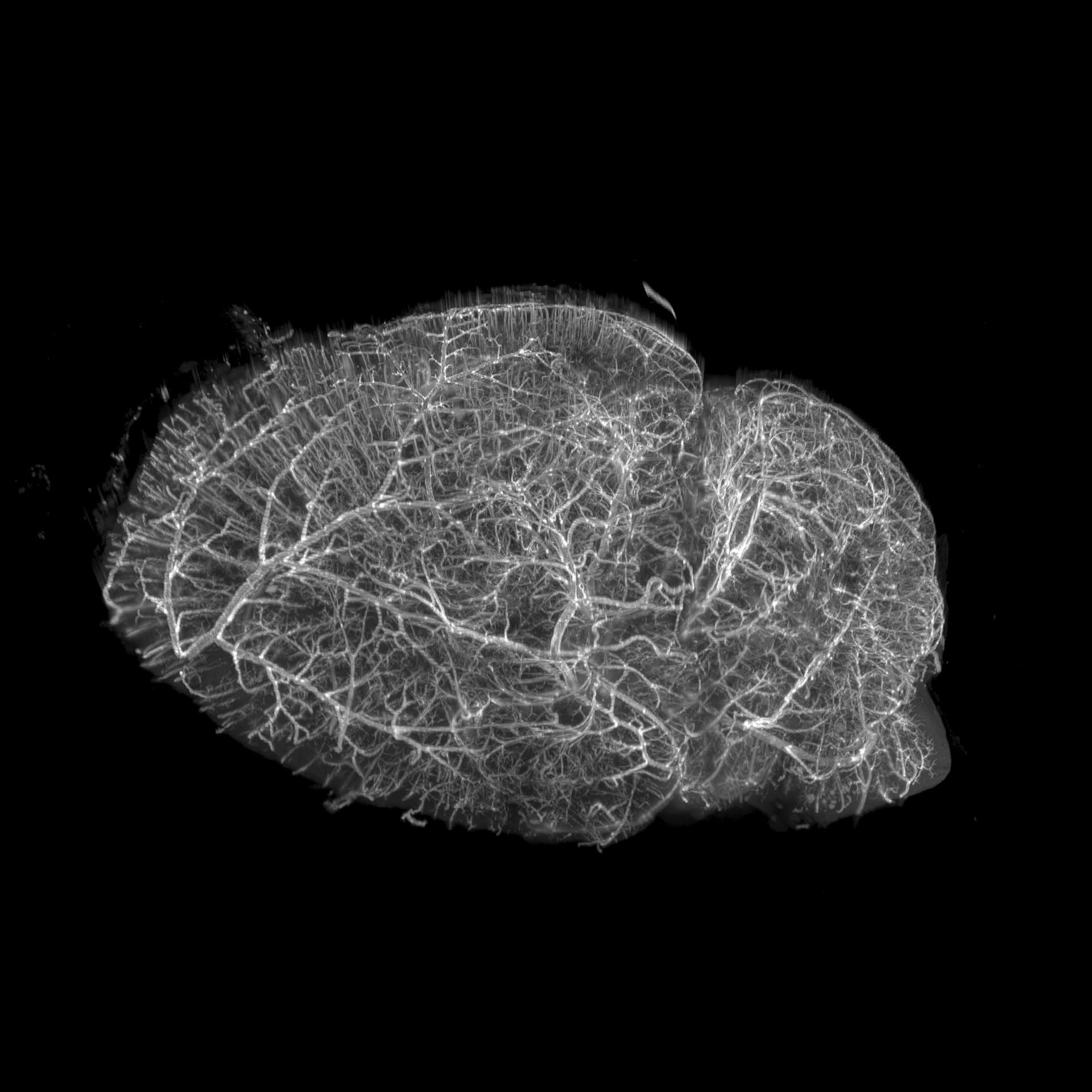 Looking Deep Into Chemically Cleared Brain & Thick Tissues