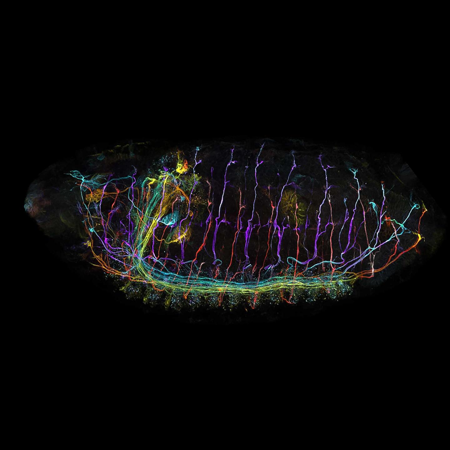 Imaging Large Model Organisms: Fixed or Living