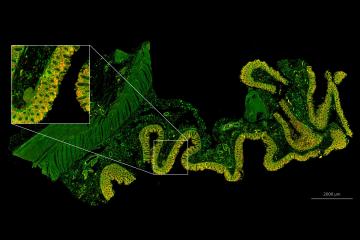Imaging Large Brain and Tissue Sections. Whole Slide Imaging